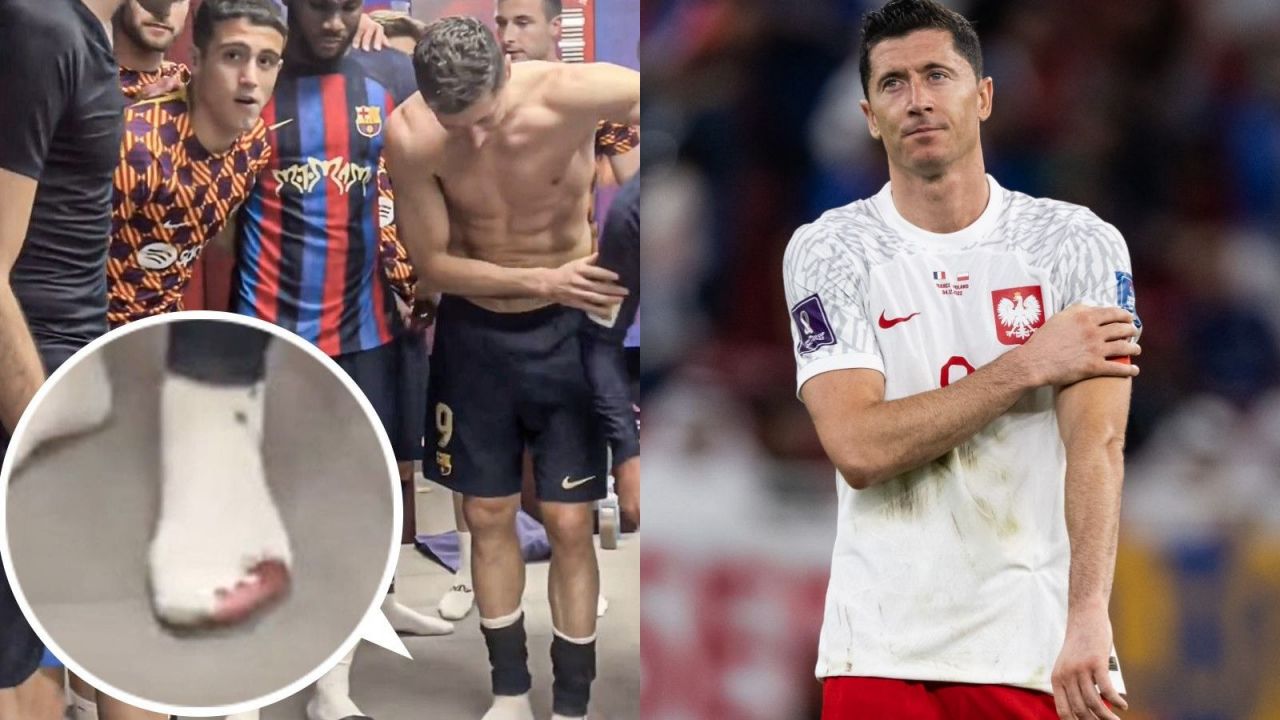 La Liga. Robert Lewandowski ucierpiał w El Clasico? Zakrwawiona stopa ...
